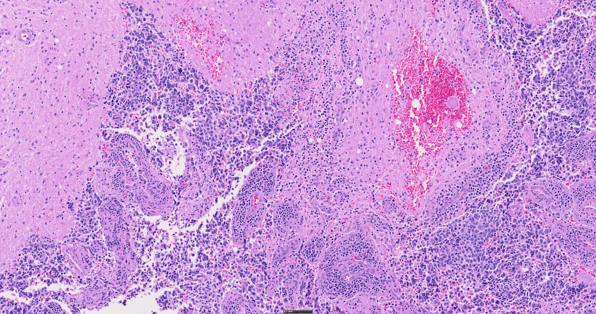 EVIDENT Introduces the SLIDEVIEW™ DX VS200 Whole Slide Scanner, a CE ...