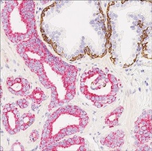 Leica Microsystems Launches the First Fully Automated One-step Dual ...