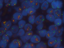 Leica Microsystems Releases Fully Automated HER2 FISH Test