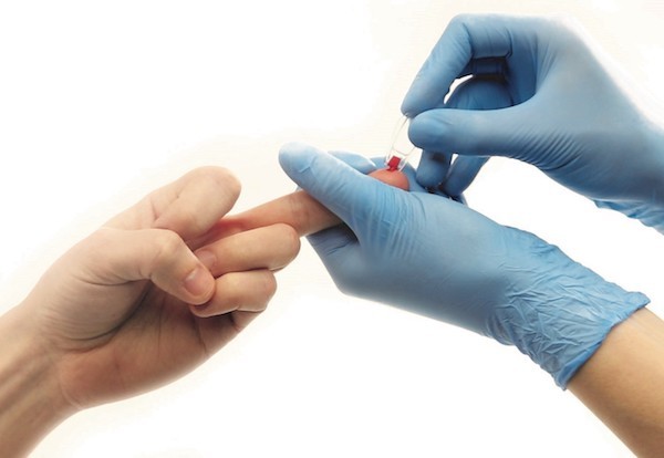 EKF Publishes Guide to Good Capillary Blood Sampling