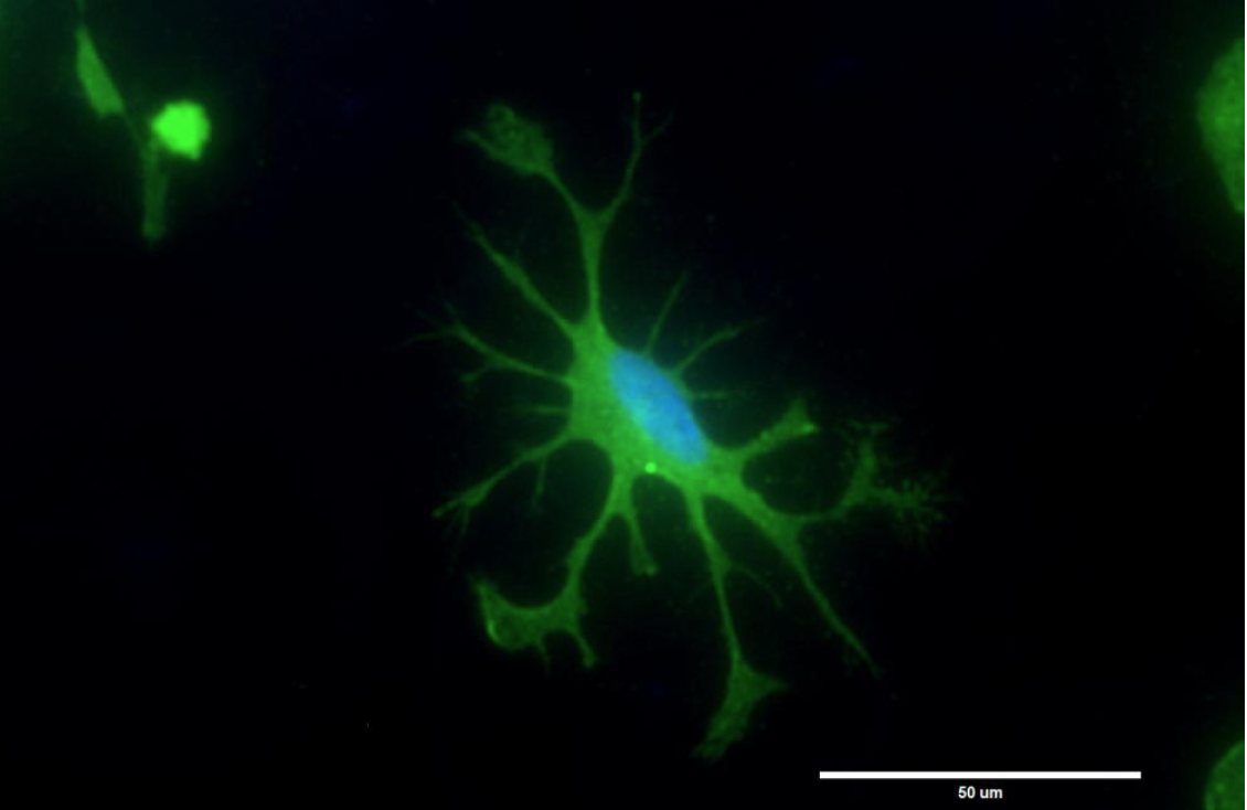 Axol Bioscience Launches Human iPSC-derived Microglia