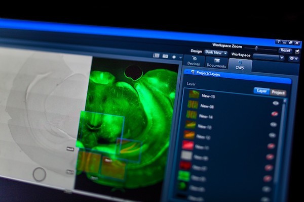 ZEISS Presents new Enhanced Software Technology